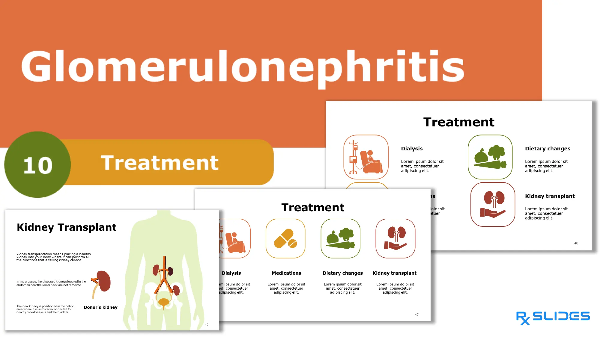 Glomerulonephritis PowerPoint Template | RxSlides The largest online store for medical ...